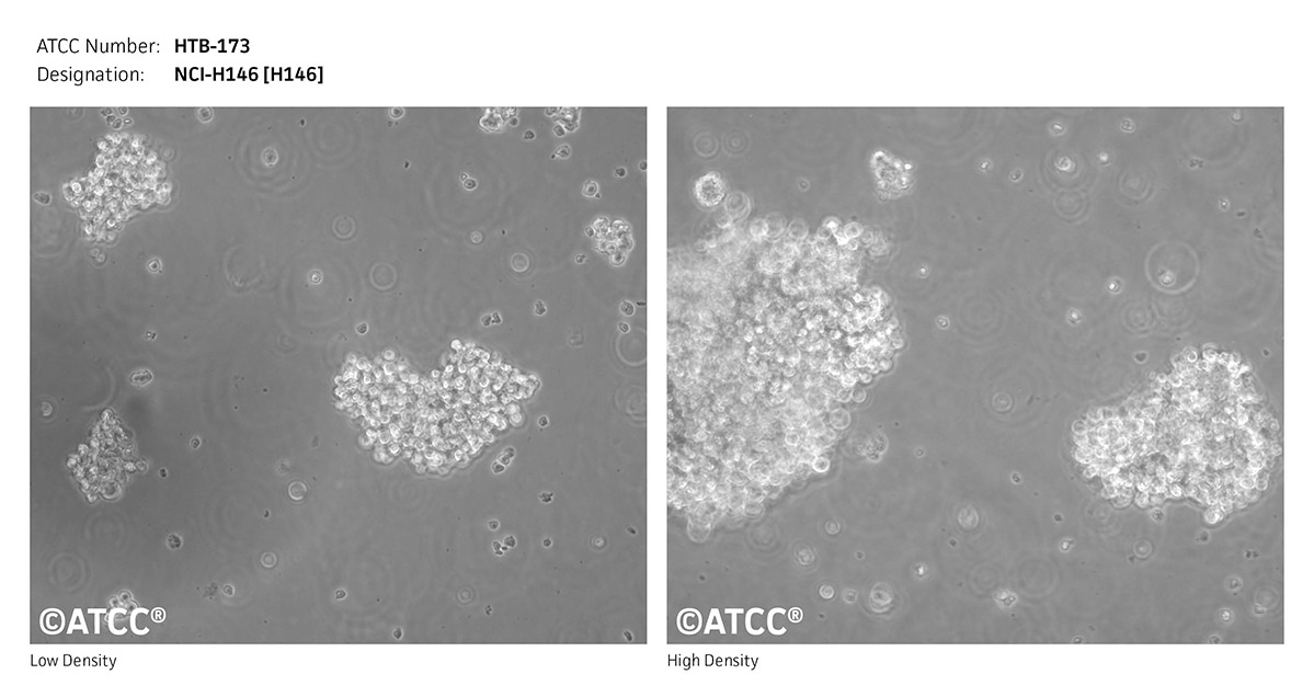 NCI-H146 [H146] - HTB-173 | ATCC