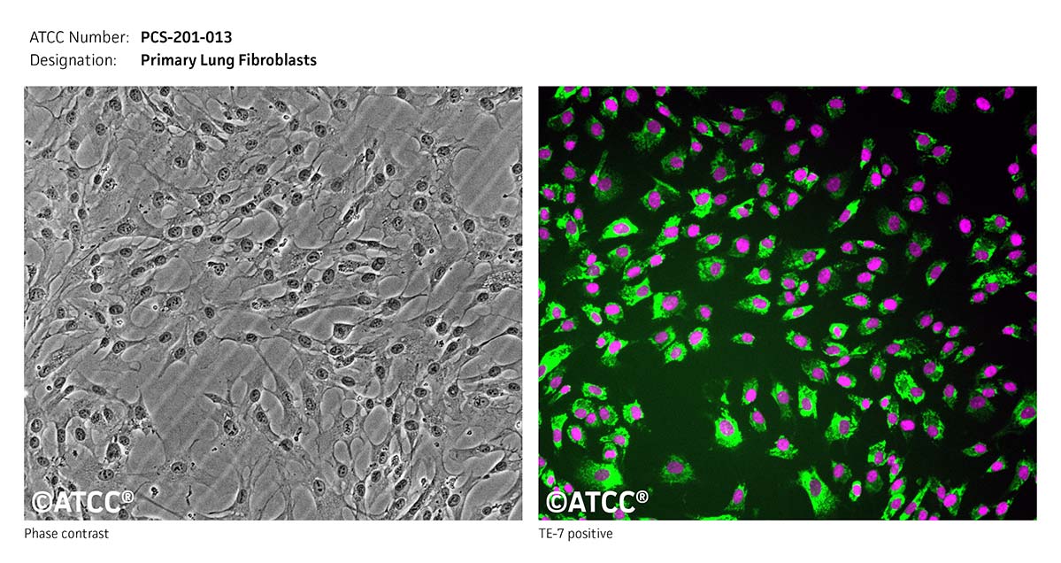 Primary Lung Fibroblast, Normal, Human (HLF) - PCS-201-013 | ATCC