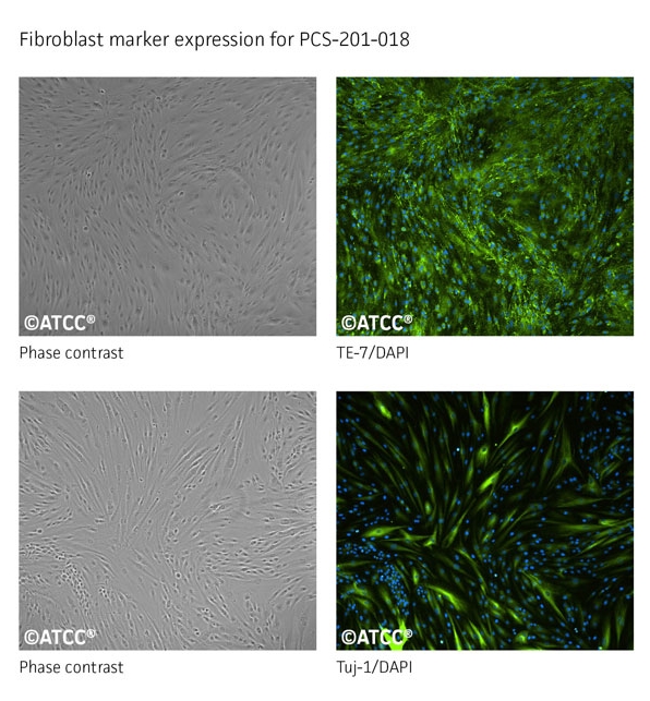Primary Gingival Fibroblast; Normal, Human, Adult (HGF) - PCS-201-018 ...