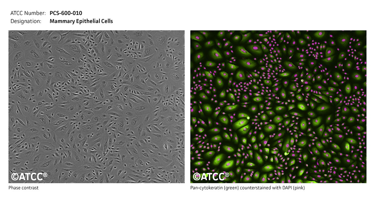 Primary Mammary Epithelial Cells; Normal, Human (HMEC) - PCS-600-010 | ATCC