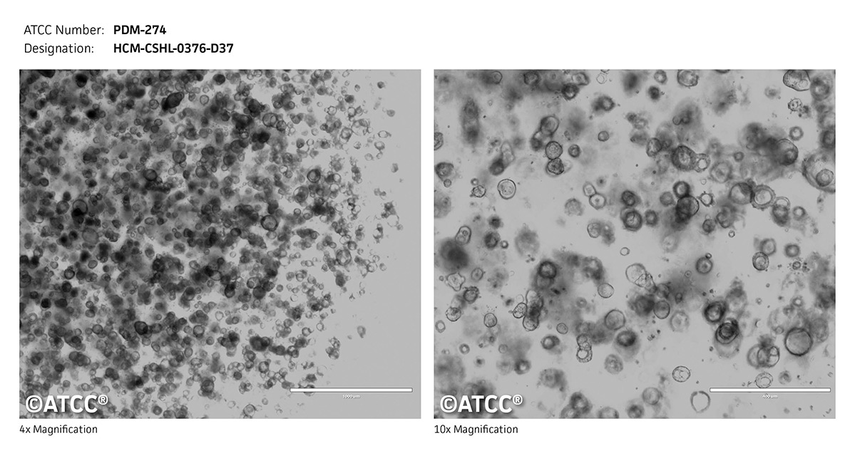 HCM-CSHL-0376-D37 - PDM-274 | ATCC