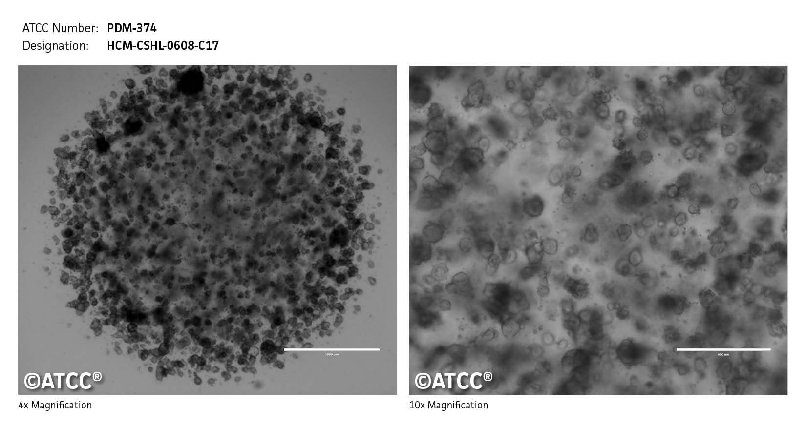 HCM-CSHL-0608-C17 - PDM-374 | ATCC