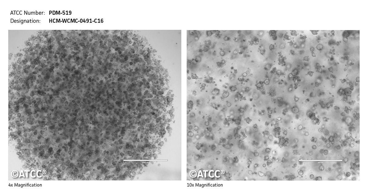 HCM-WCMC-0491-C16 - PDM-519 | ATCC
