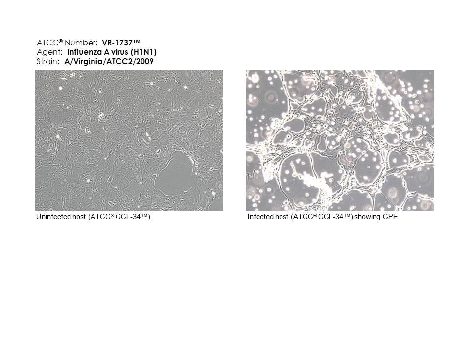 Influenza A virus (H1N1) - VR-1737 | ATCC